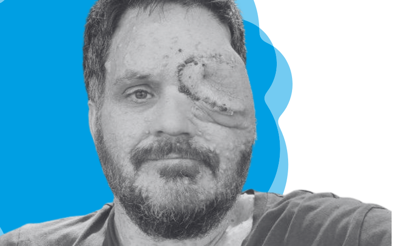 Oliver Bromley's NF Story | Nerve Tumours UK