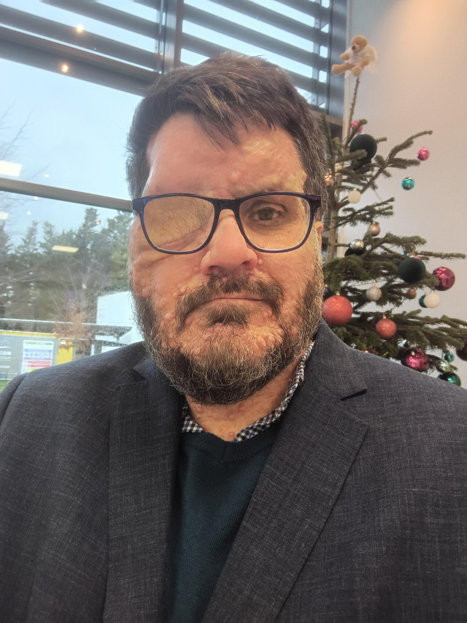 Oliver Bromley - Reflections of 2025 - Outlook to 2026 | Nerve Tumours UK